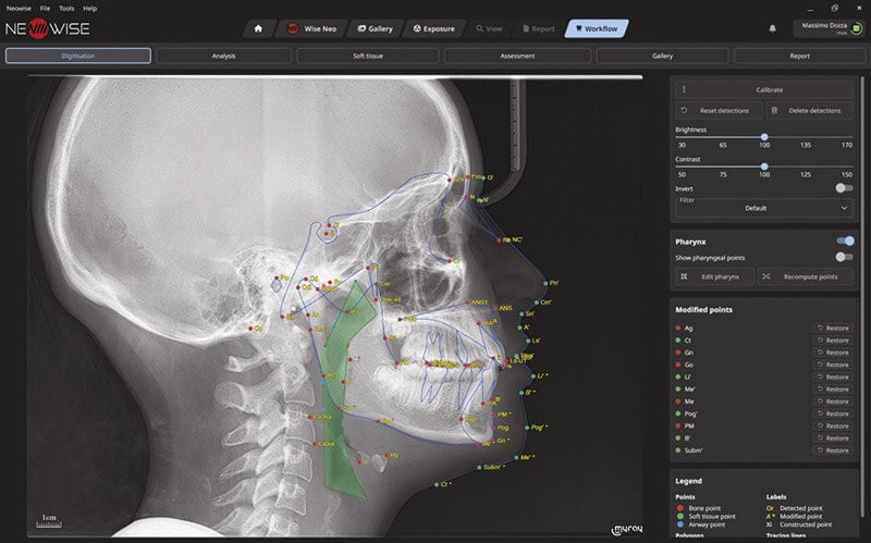 Neowise: Dental Imaging Software | Castellini